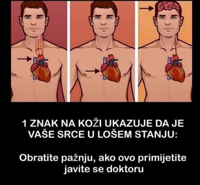 1 ZNAK NA KOŽI UKAZUJE DA JE VAŠE SRCE U LOŠEM STANJU: Obratite pažnju, ako ovo primijetite ...